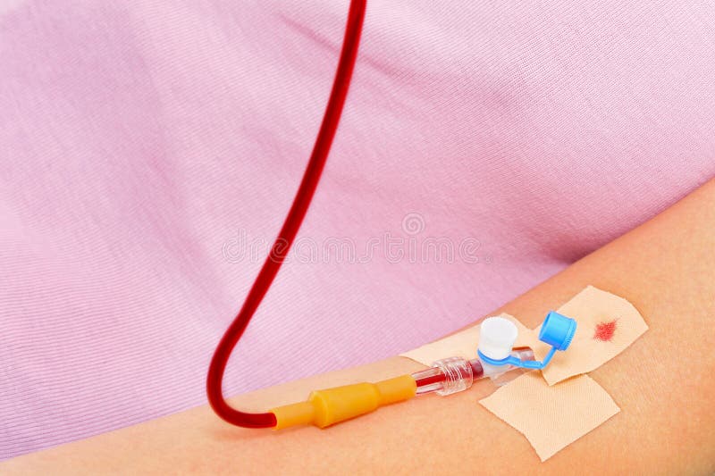 Blodtransfusion arkivfoto. Bild av omsorg, terapi, vätska - 33211856