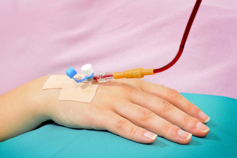 Blodtransfusion arkivfoto. Bild av kemoterapi, transfuse - 33211856