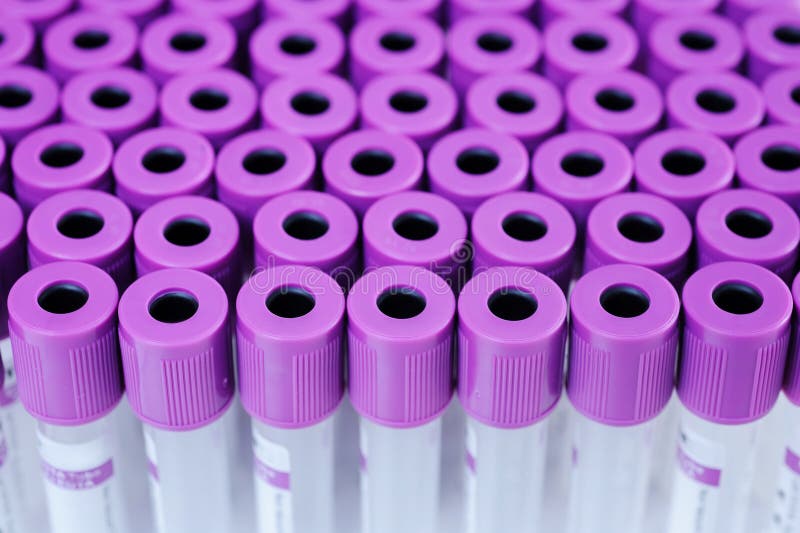 Rek Van Bloedbuizen Die in Het Laboratorium Van De Bloedbank Worden ...