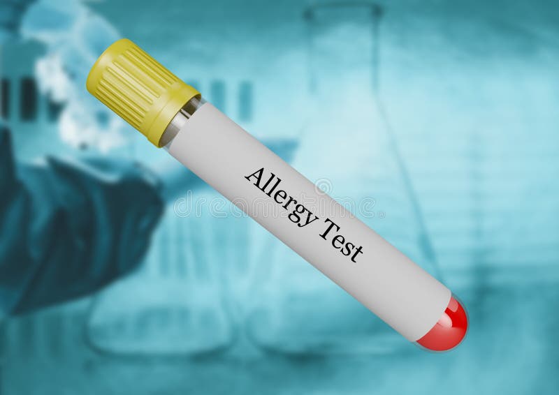 Blood Allergy Test Collected in Test Tube Isolated by Selective Focus ...