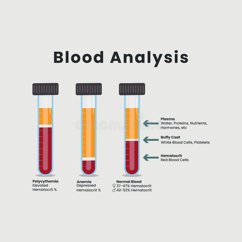 Blood Analysis in Test Tubes Design Vector Stock Vector - Illustration ...
