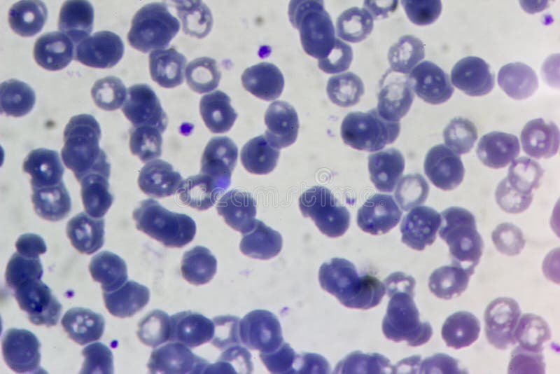 Pill Under Microscope Stock Photos - Free & Royalty-Free Stock Photos ...