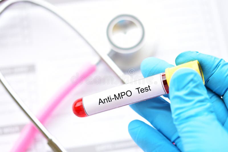 Blood for anti-MPO test stock photo. Image of antibodies - 149955898