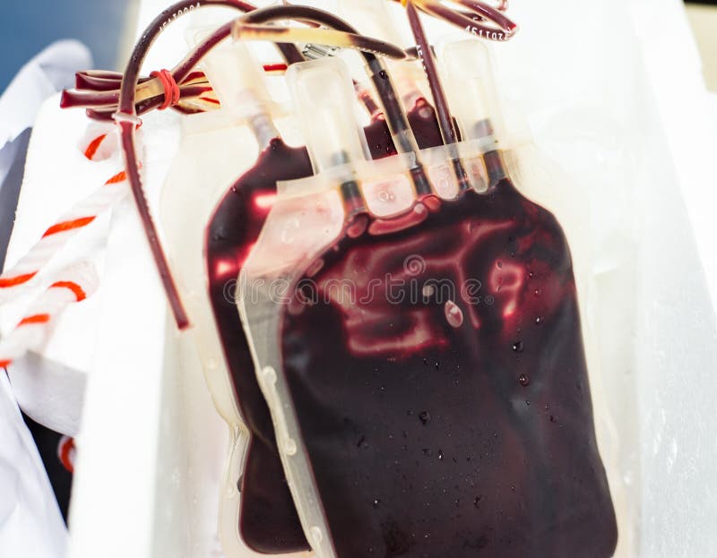 Blood bag stock photo. Image of care, clinic, scientific - 56813300