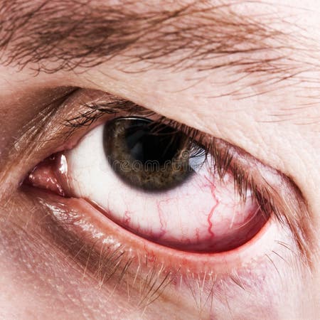 Blood capillary human eye stock photo. Image of medical - 20206732