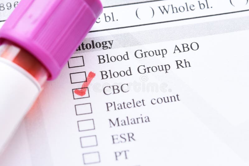 Blood for CBC test stock image. Image of research, health - 113934155