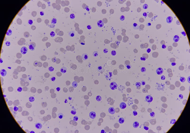 Blood Cell Microscopic View Stock Illustration - Illustration of ...