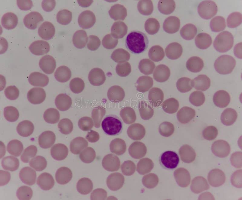 Blood Cells with Microscope. Stock Image - Image of medical, natural ...