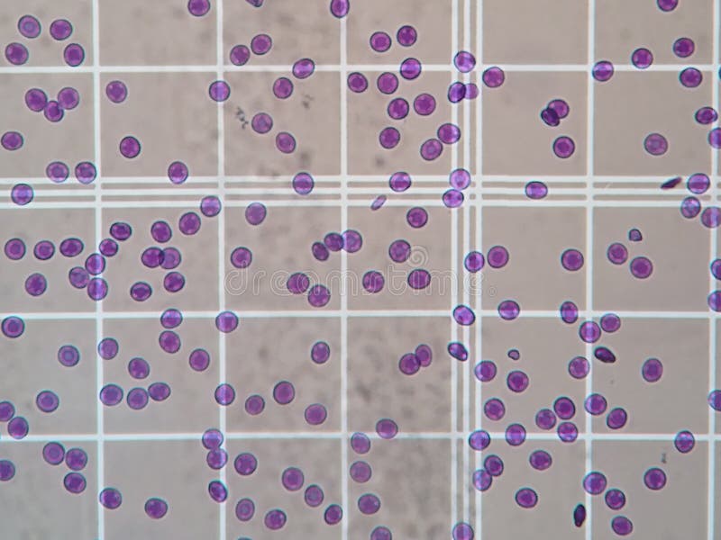 Hemocytometer Under Microscope