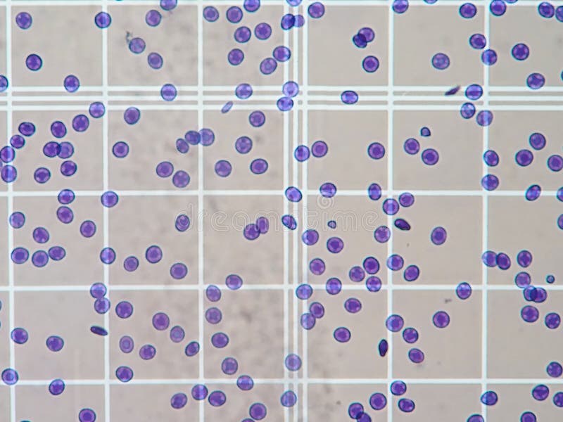 Hemocytometer Wbc