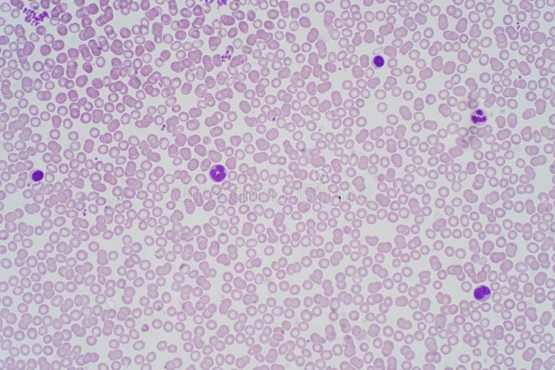 Blood Cells Under Microscope Stock Photo - Image of hematies, closeup ...