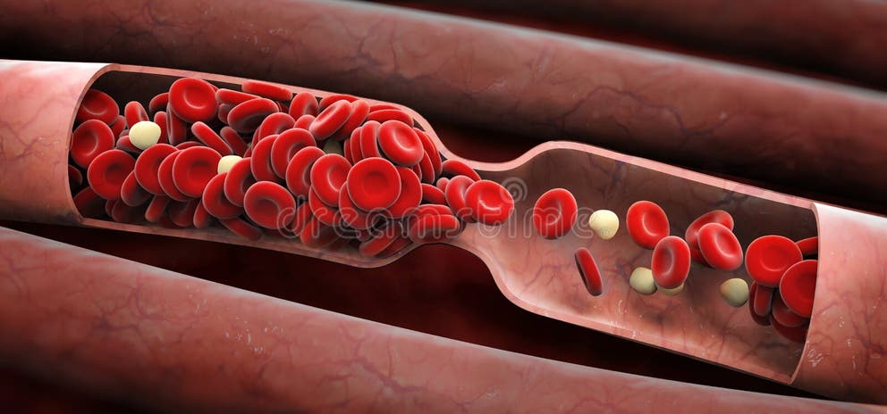 Blood clot stock photo. Image of human, molecular, beauty - 56523250