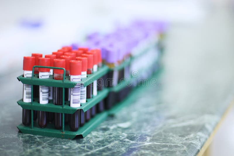 Blood collection tray stock photo. Image of exam, diagnostic - 65917868