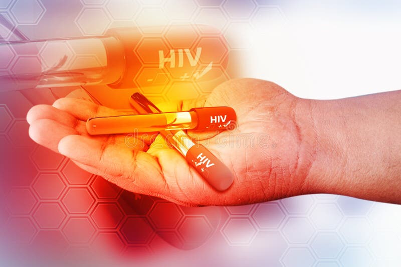Blood Collection Tube with HIV Test Stock Photo - Image of ...