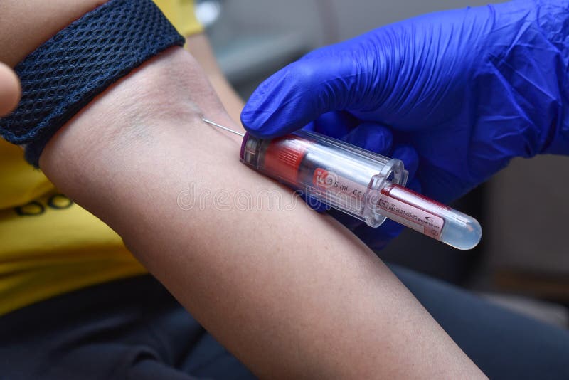 Blood Collection Using Venipuncture Technique Stock Image - Image of ...