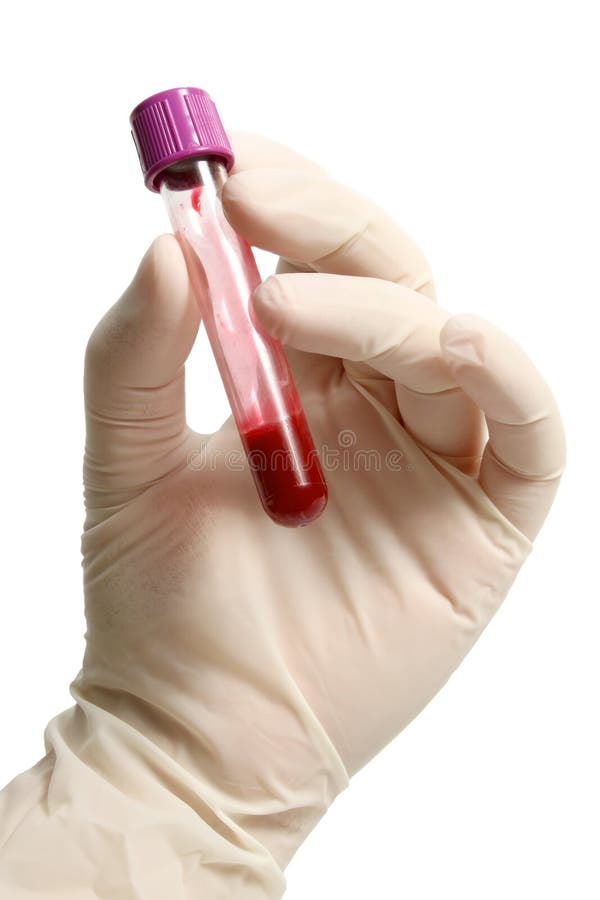 Blood Container in Hand with Glove Stock Image - Image of isolated ...