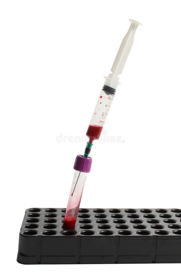 Blood Container and Syringe on Stand. Stock Photo - Image of experiment ...
