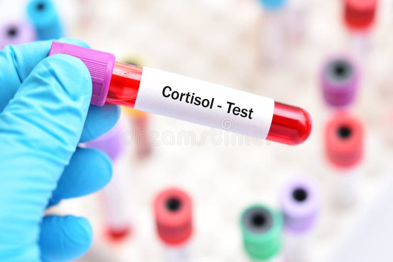 Blood for Cortisol Hormone Test Stock Image - Image of analyzing ...