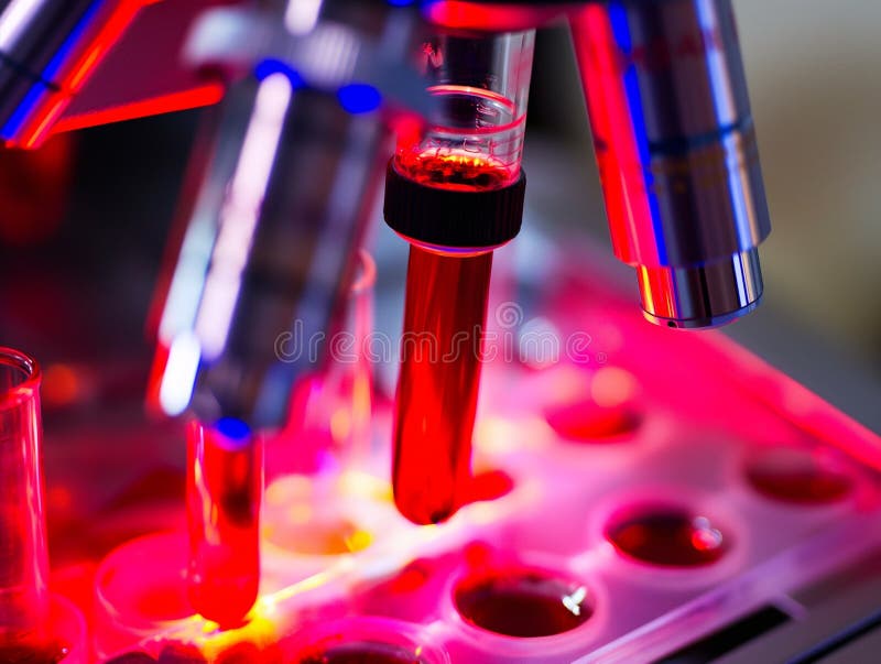 Blood Drawing Equipment in Laboratory for Analysis Stock Photo - Image ...