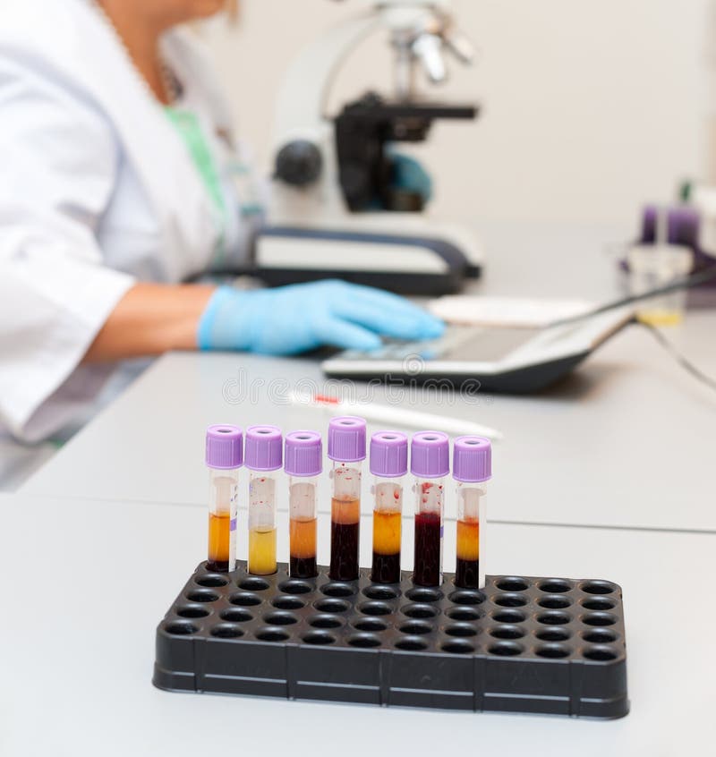 Blood examination stock photo. Image of examine, hold - 25923284