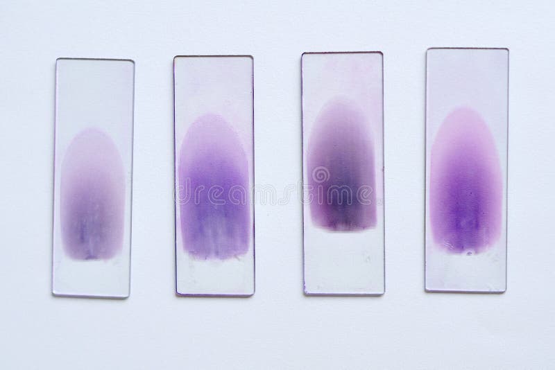Blood film stock photo. Image of scientific, research - 20772940