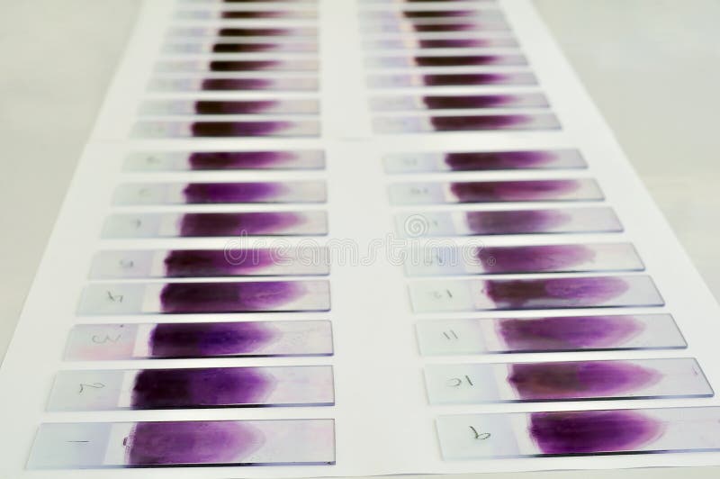 Blood film stock photo. Image of equipment, medicine - 20855080