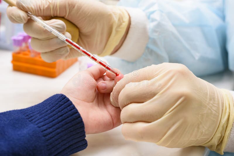 Blood Finger Test of Baby stock image. Image of field - 137600521