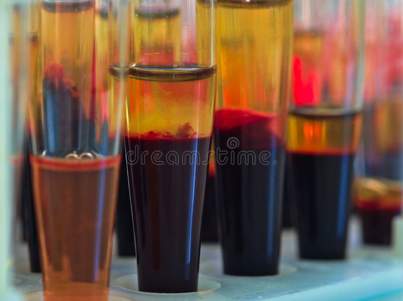 Blood in flasks on a rack. stock photo. Image of beaker - 176840500