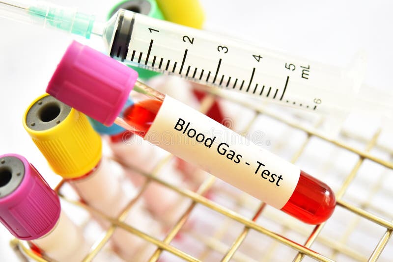 Blood gas test stock photo. Image of care, acid, carbonate - 158762832