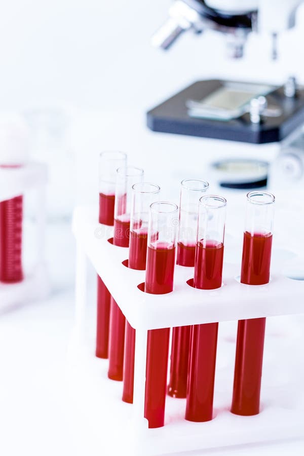 Blood In Glass Tubes On Background Of Microscope Stock Image - Image of ...