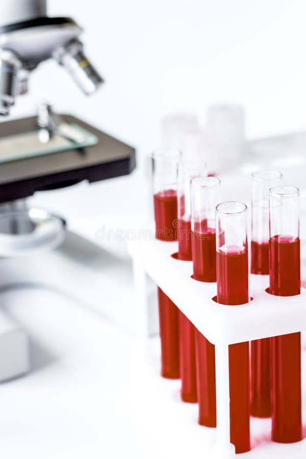 Blood in Glass Tubes on Background of Microscope Top View Stock Photo ...