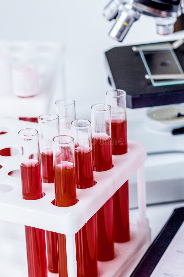 Blood in Glass Tubes on Background of Microscope Stock Image - Image of ...