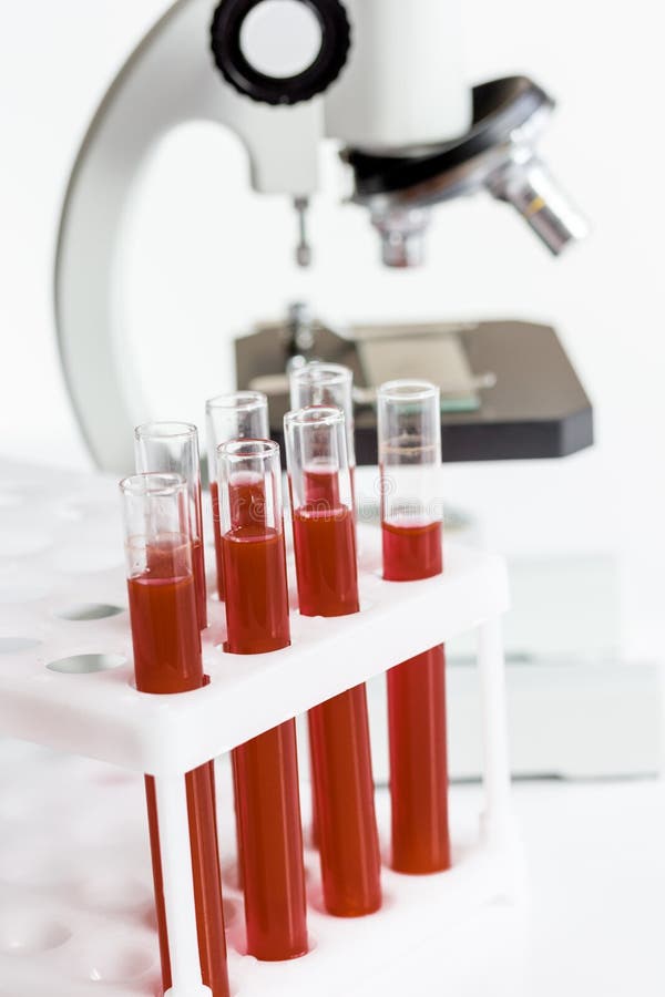 Blood in Glass Tubes on Background of Microscope Stock Photo - Image of ...