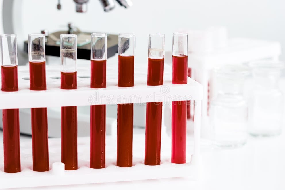 Blood in Glass Tubes on Background of Microscope Stock Image - Image of ...
