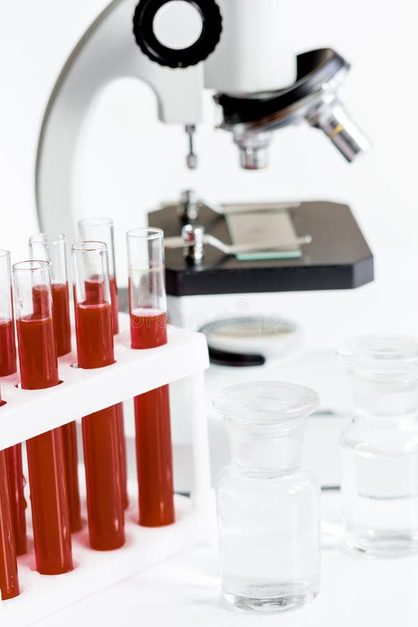 Blood in Glass Tubes on Background of Microscope Stock Photo - Image of ...