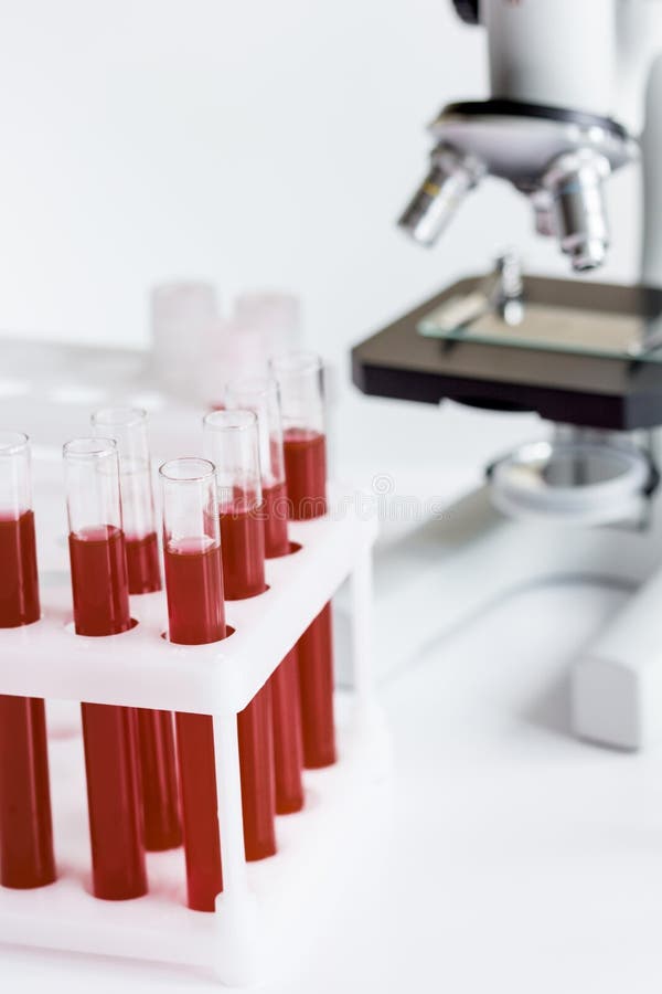 Blood in Glass Tubes on Background of Microscope Stock Image - Image of ...