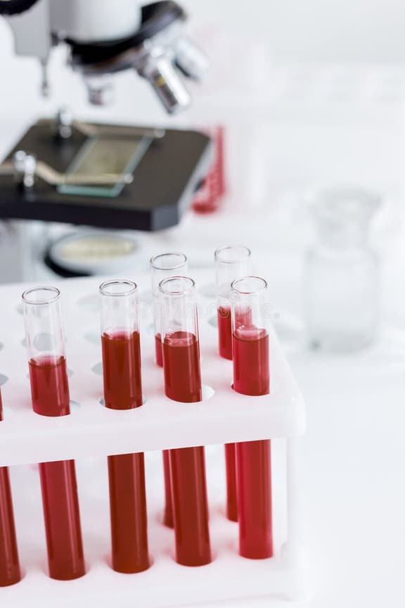 Blood in Glass Tubes on Background of Microscope Stock Image - Image of ...