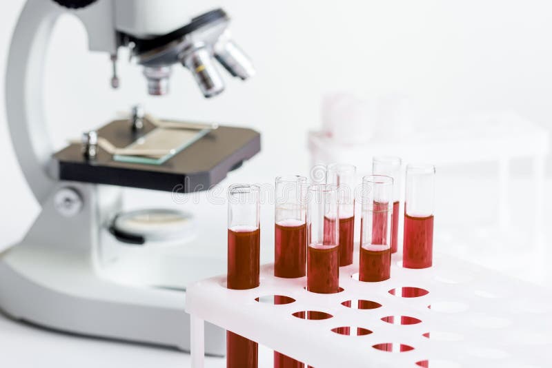 Blood in Glass Tubes on Background of Microscope Stock Photo - Image of ...
