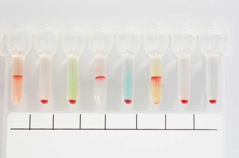 Blood Group ABO Typing Gel Test Stock Image - Image of method, research ...