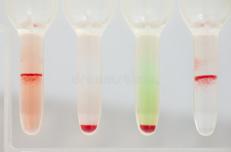 Blood Group ABO Typing Gel Test Stock Photo - Image of diagram ...