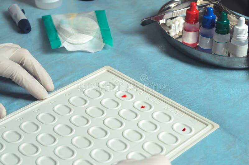 Blood Group and Rh Factor Testing Stock Photo - Image of immunology ...