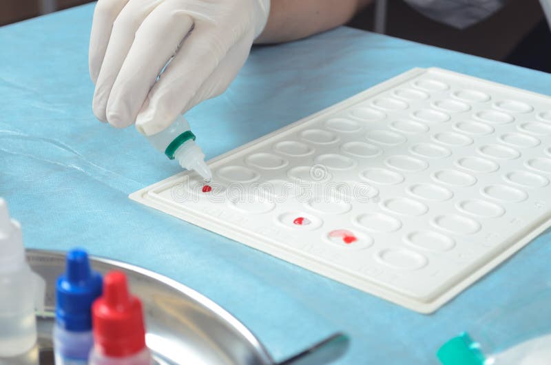 Blood Group and Rh Factor Testing Stock Photo - Image of donation ...