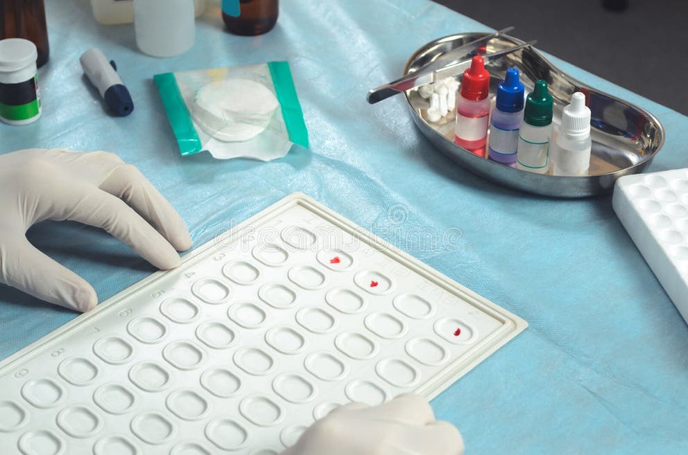 Blood Group and Rh Factor Testing Stock Image - Image of medical ...
