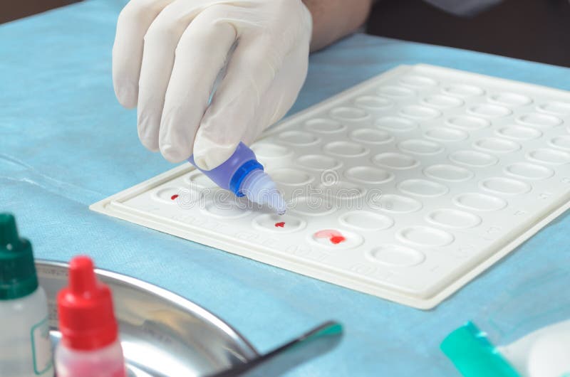 Blood Group and Rh Factor Testing Stock Photo - Image of group, cells ...