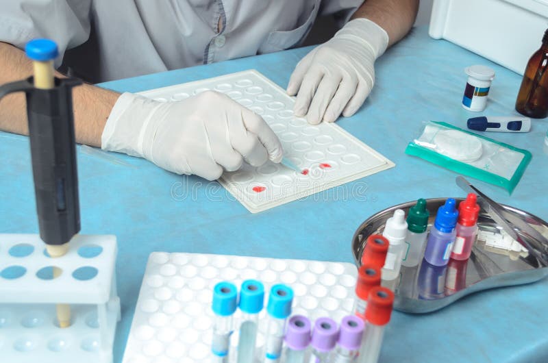 Blood Group and Rh Factor Testing Stock Photo - Image of group, cells ...