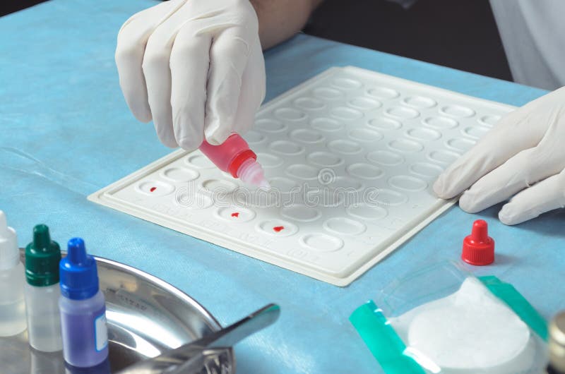 Blood Group and Rh Factor Testing Stock Photo - Image of group, cells ...