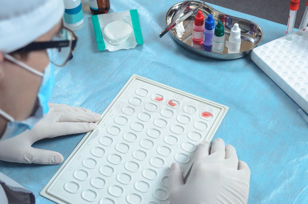 Blood Group and Rh Factor Testing Stock Photo - Image of hematology ...