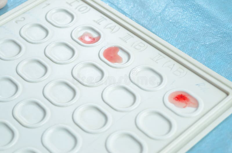Blood Group and Rh Factor Testing Stock Image - Image of expertise ...