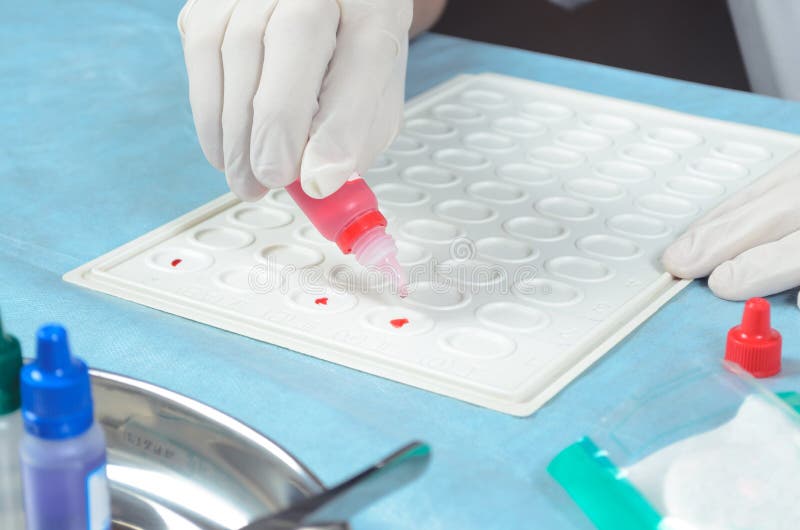 Blood Group and Rh Factor Testing Stock Photo - Image of donation ...