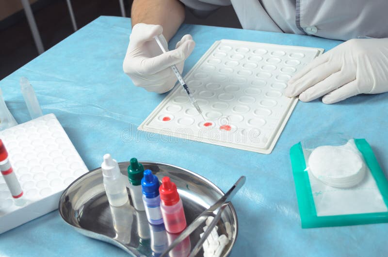 Blood Group and Rh Factor Testing Stock Photo - Image of group, cells ...